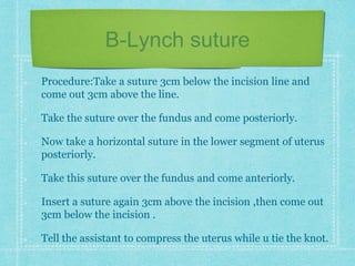 Surgical Management of Postpartum Hemorrhage | PPTX