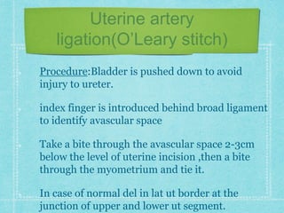 Surgical Management of Postpartum Hemorrhage | PPT