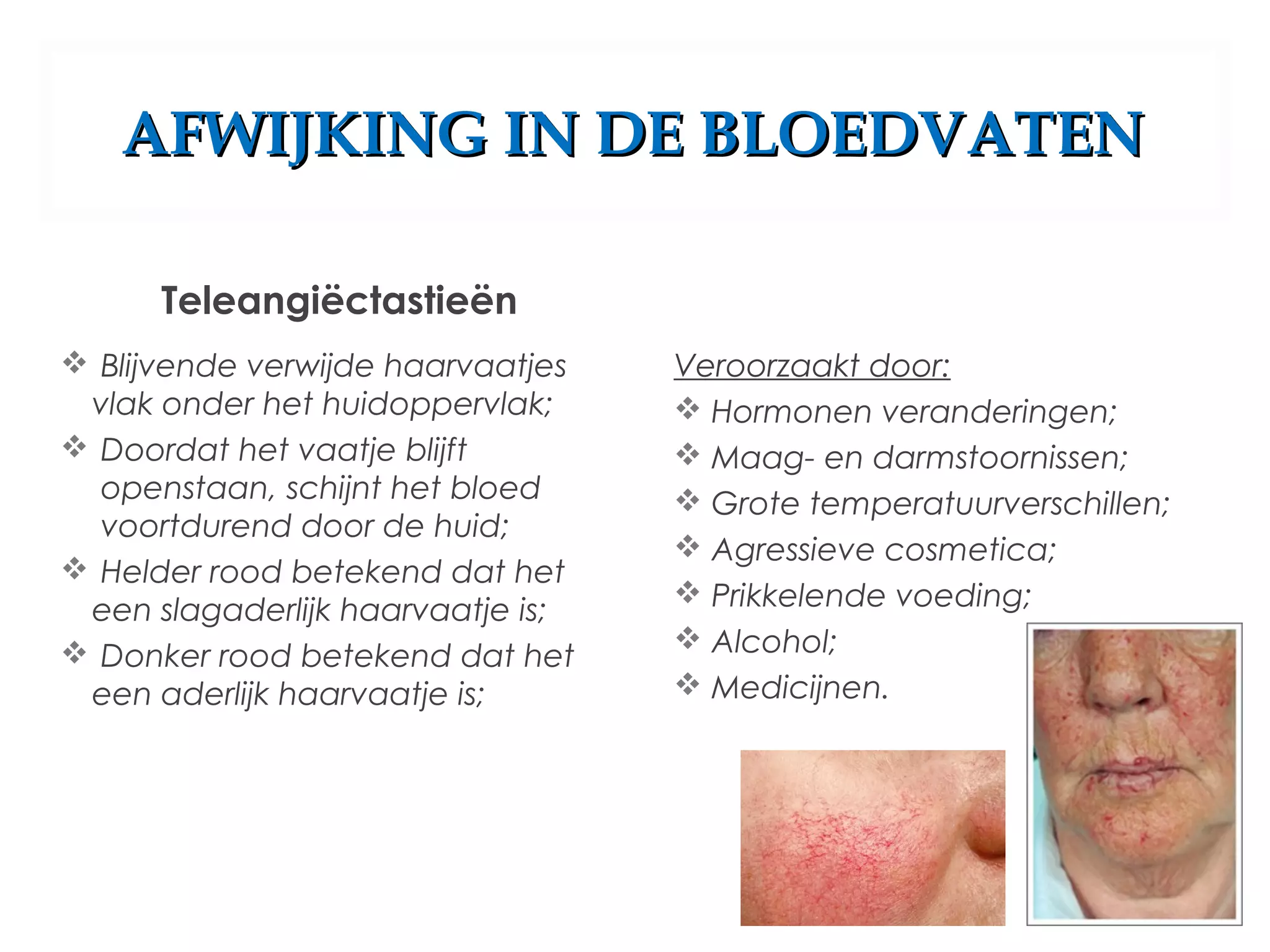 Les huidafwijkingen | PPT