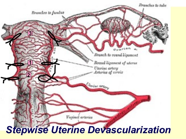 Pph work shop part ii 10 2013