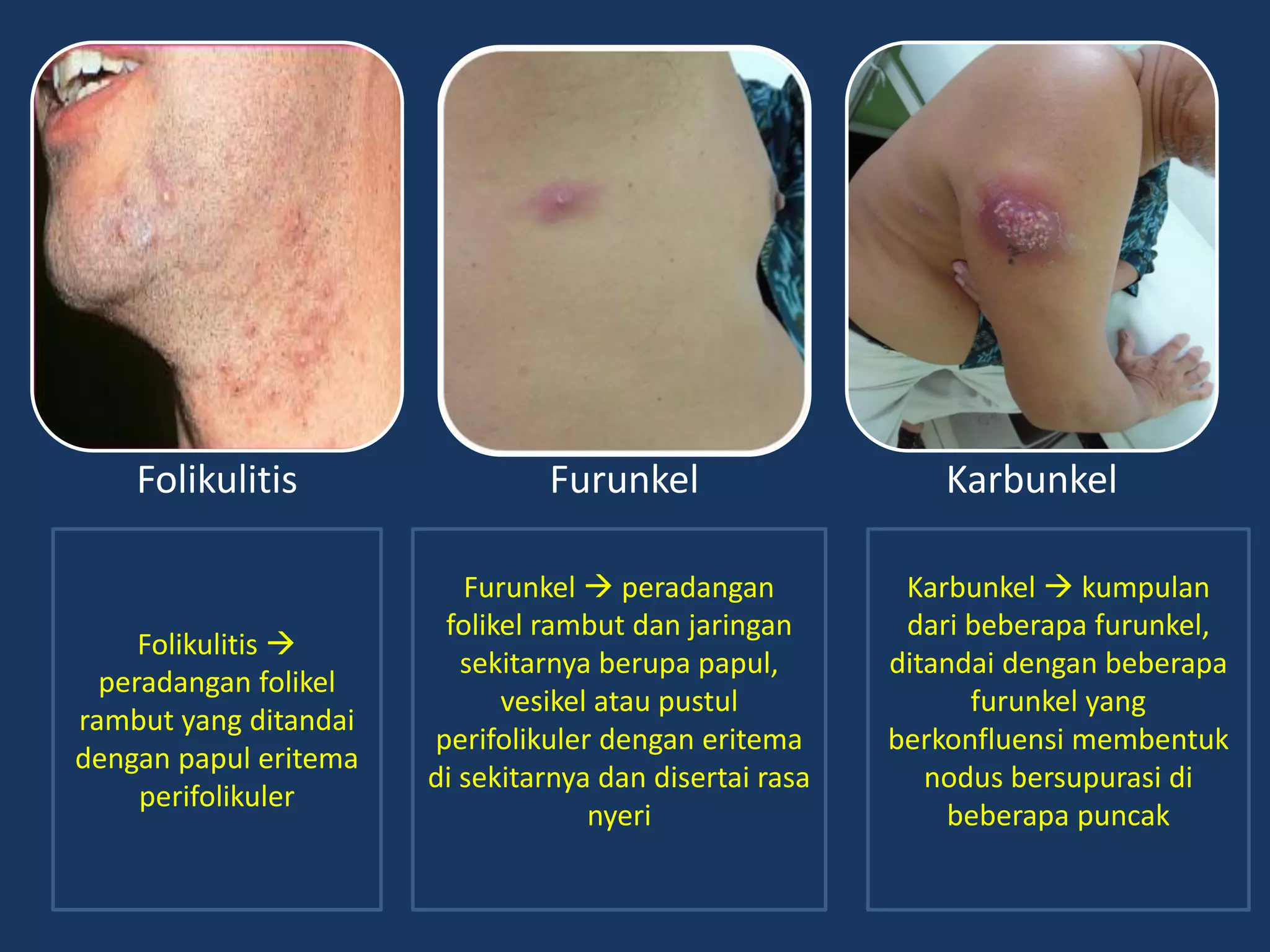 PENATALAKSANAAN TERKINI PENYAKIT KULIT DALAM PRAKTEK SEHARI HARI | PDF