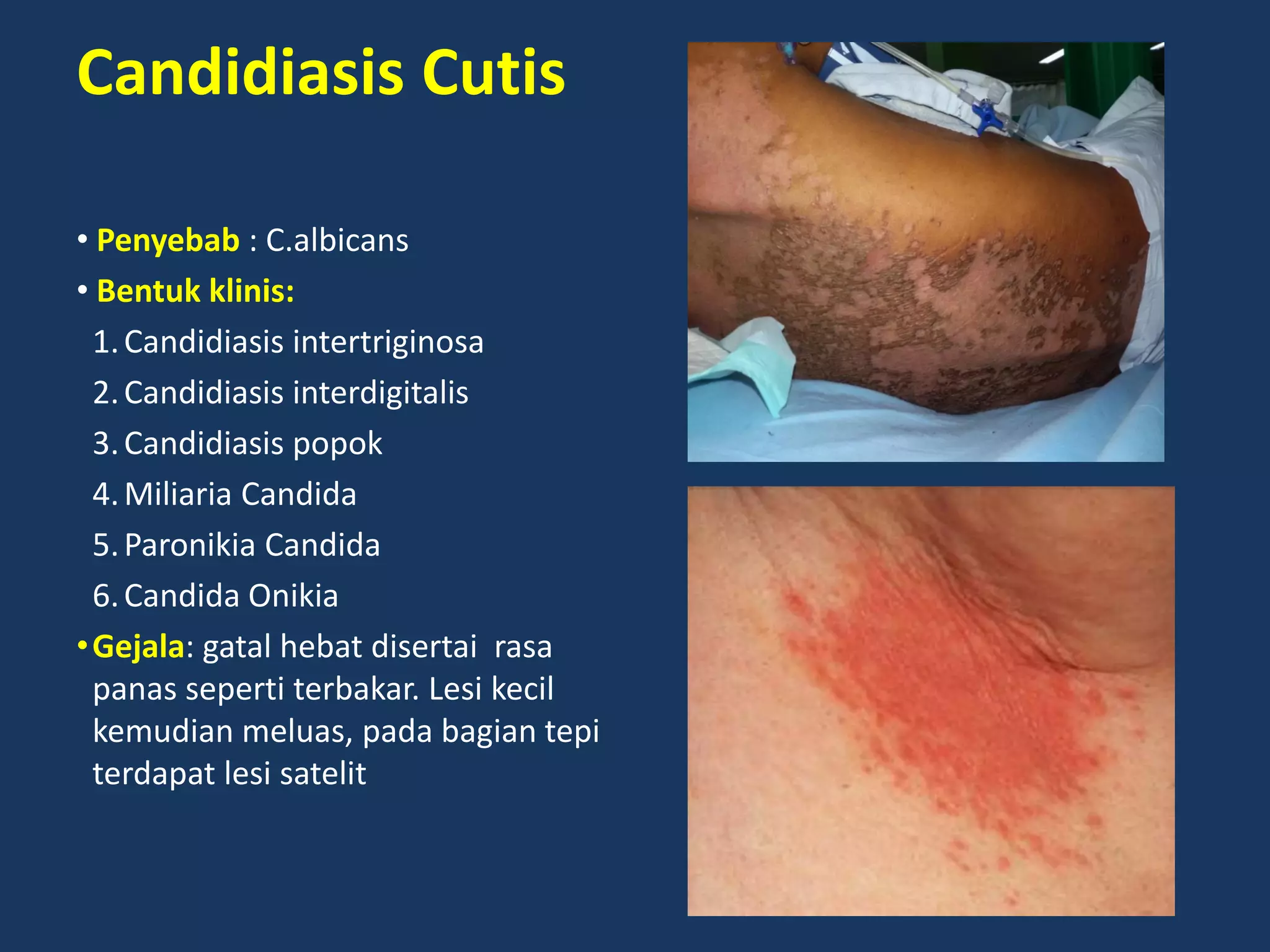 PENATALAKSANAAN TERKINI PENYAKIT KULIT DALAM PRAKTEK SEHARI HARI | PDF