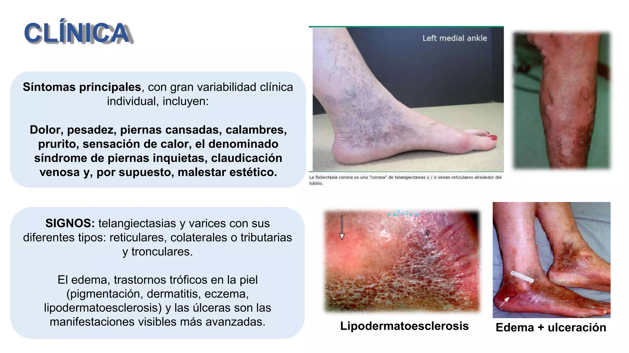 PP Insuficiencia arterial y venosa .pptx