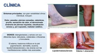 PP Insuficiencia arterial y venosa .pptx