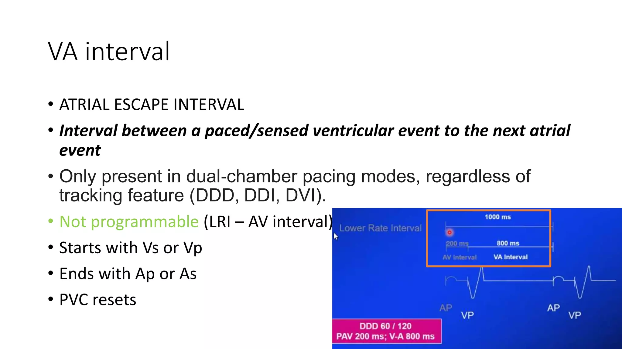 Pacemaker timing cycle harsh.pptx