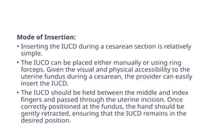 PPIUCD!!!.pptx obstetrics and gynaecology | PPTX