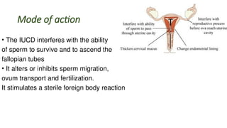 PPIUCD!!!.pptx obstetrics and gynaecology | PPTX