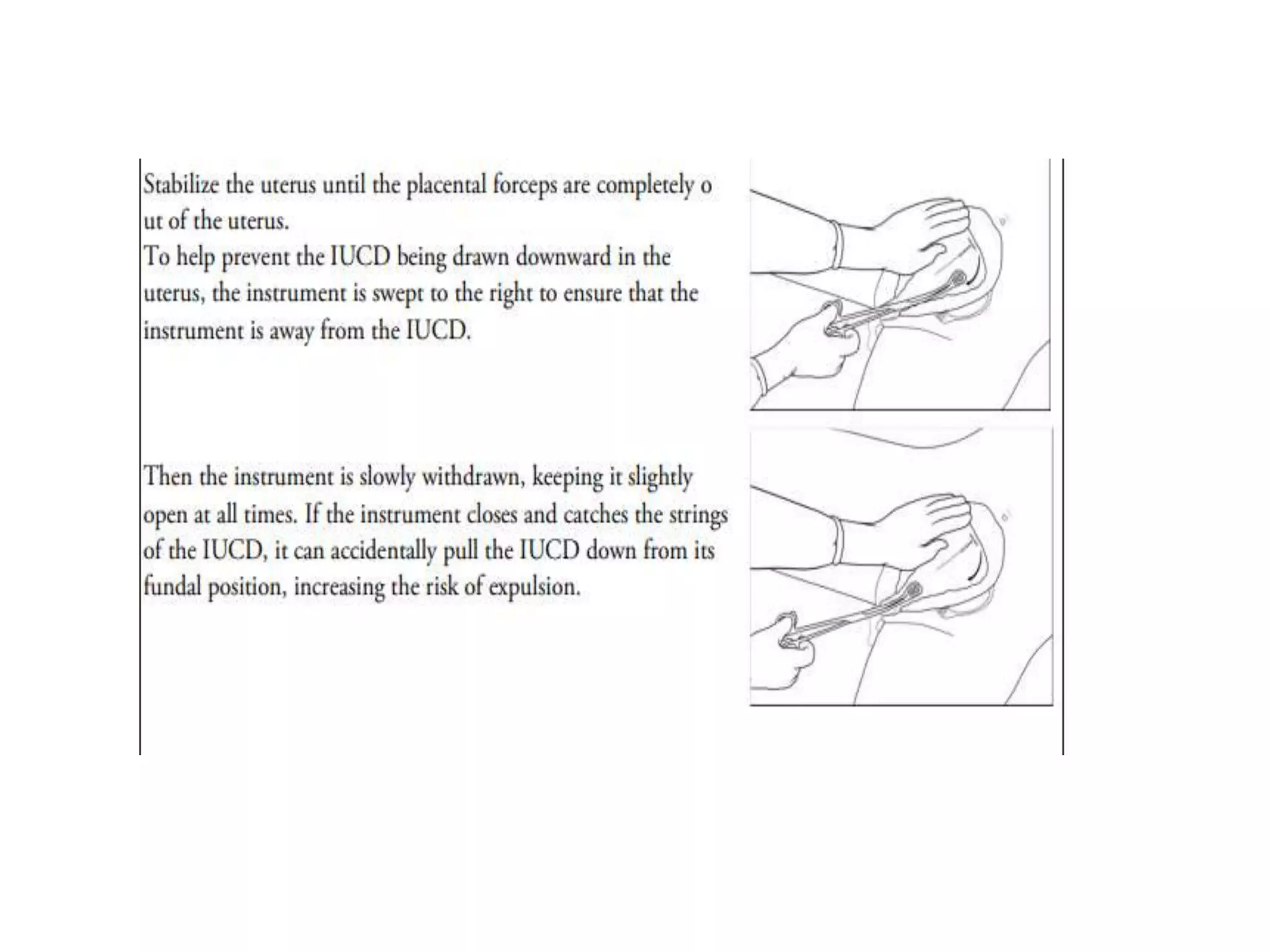 PPIUCD Programme.pptx