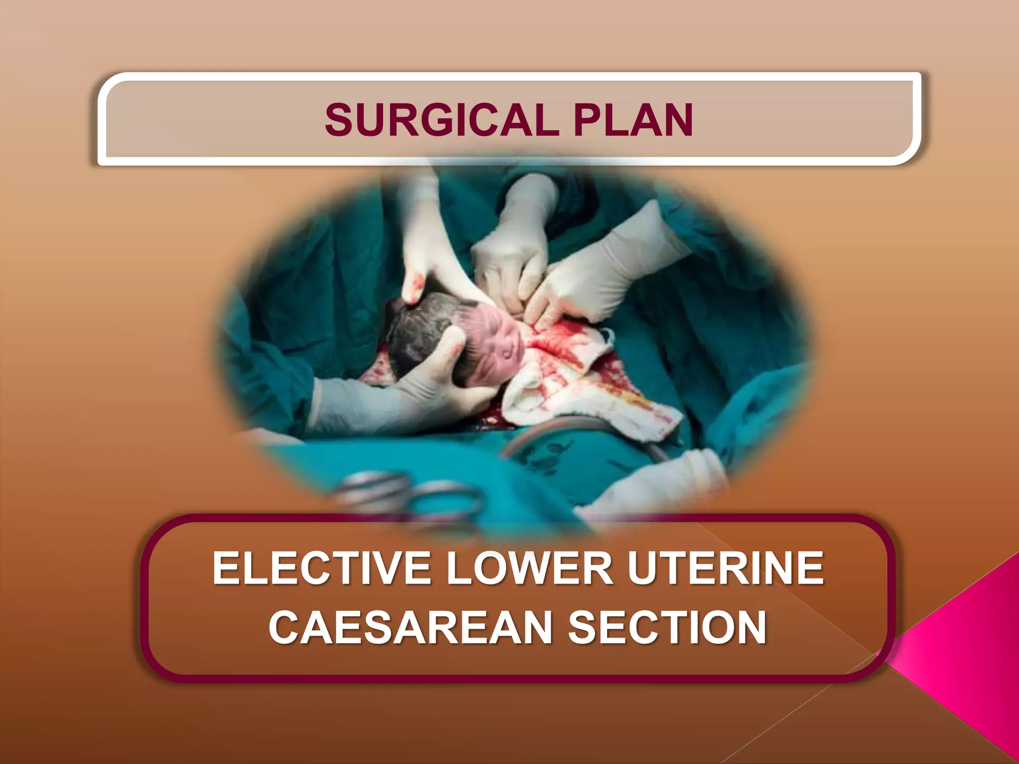 Anaestehsia for Cesarean section in a patient with Central Placenta Previa with Percreta | PPTX