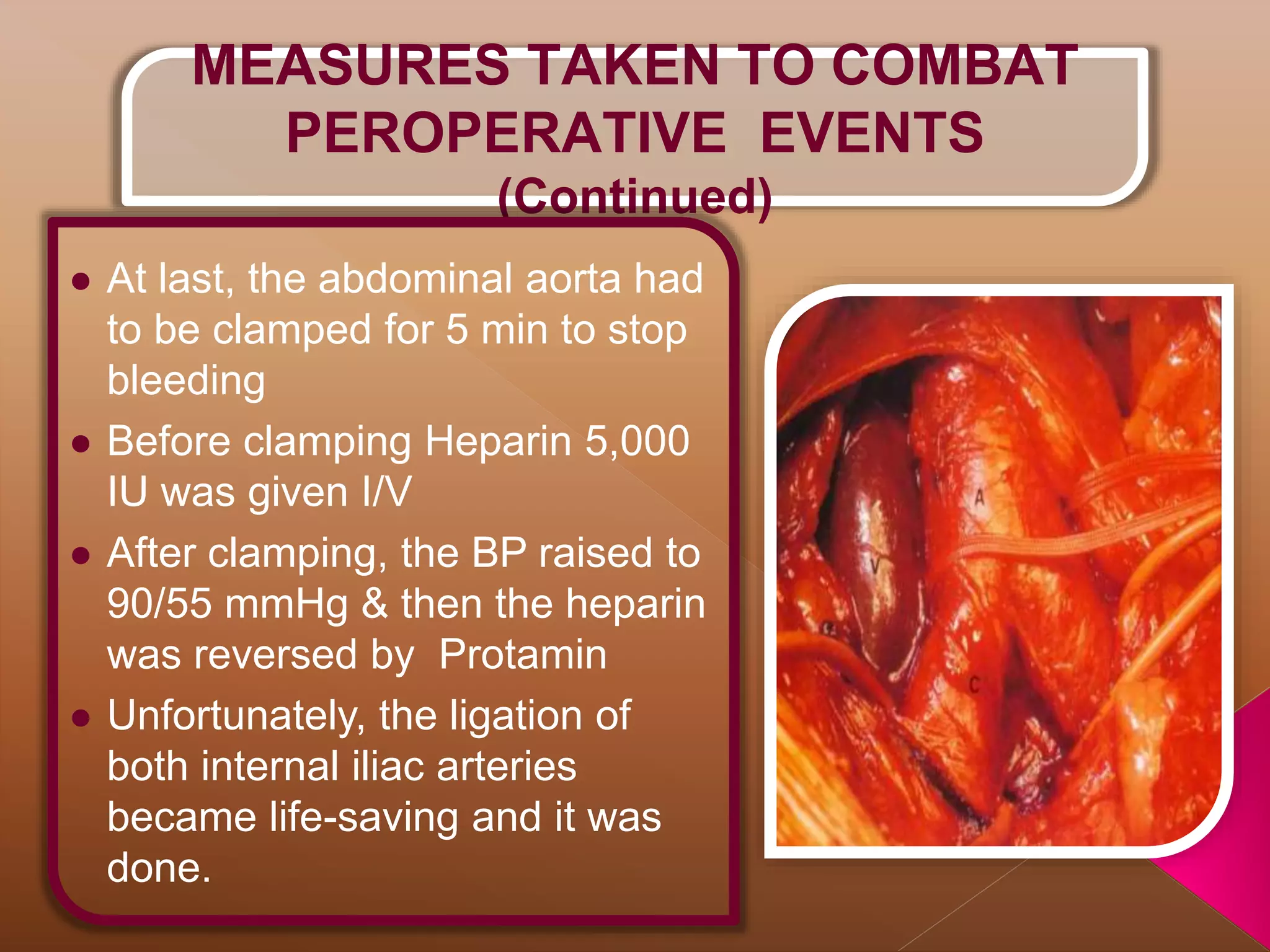 Anaestehsia for Cesarean section in a patient with Central Placenta ...