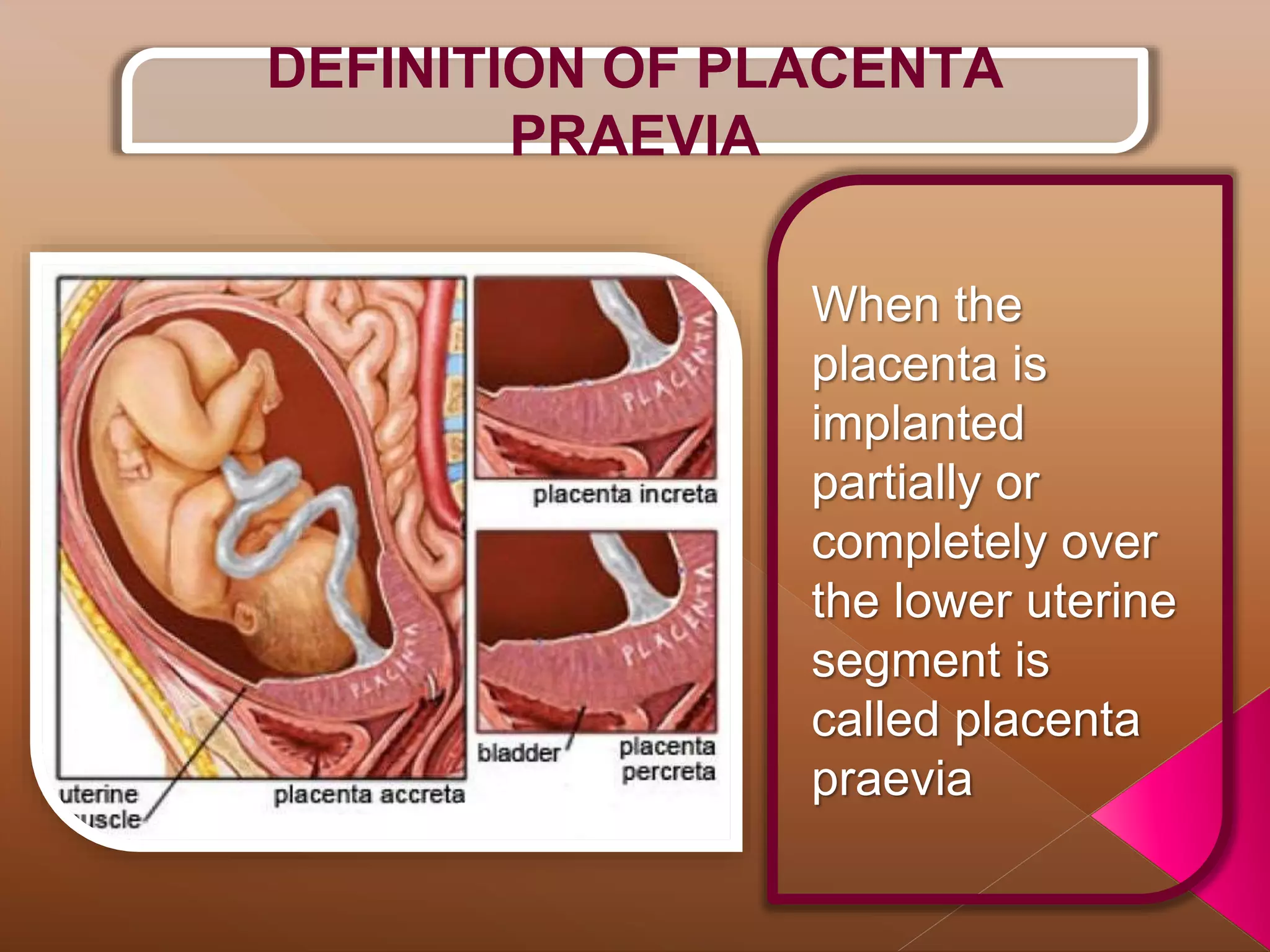 Anaestehsia for Cesarean section in a patient with Central Placenta Previa with Percreta | PPTX