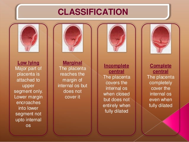 Anaestehsia for Cesarean section in a patient with Central Placenta P…