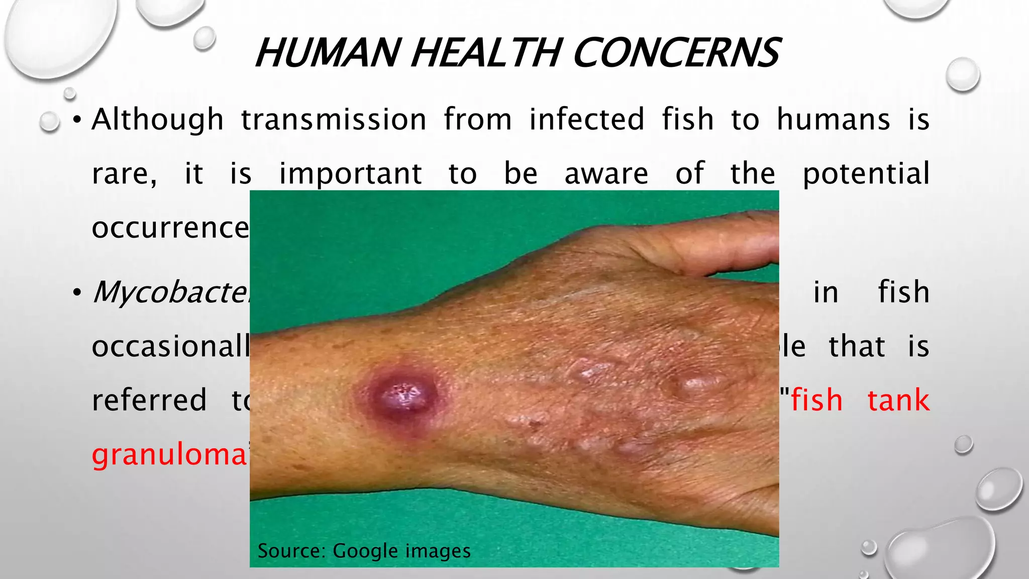 Mycobacteriosis or fish tuberculosis | PPTX