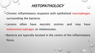 Mycobacteriosis or fish tuberculosis | PPT