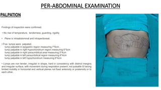 ABDOMINAL LUMP | PPTX
