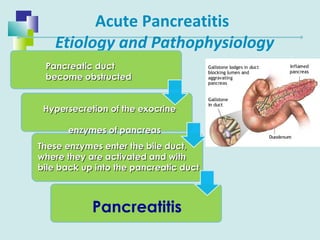 pancreatitis and pancreatic cancer | PPT