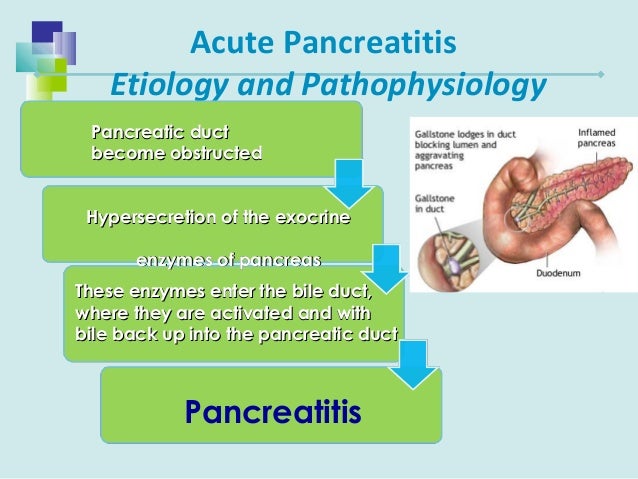 pancreatitis and pancreatic cancer