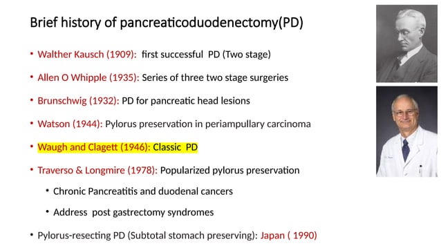pylorus preseving pancreaticoduodenectomy.pptx