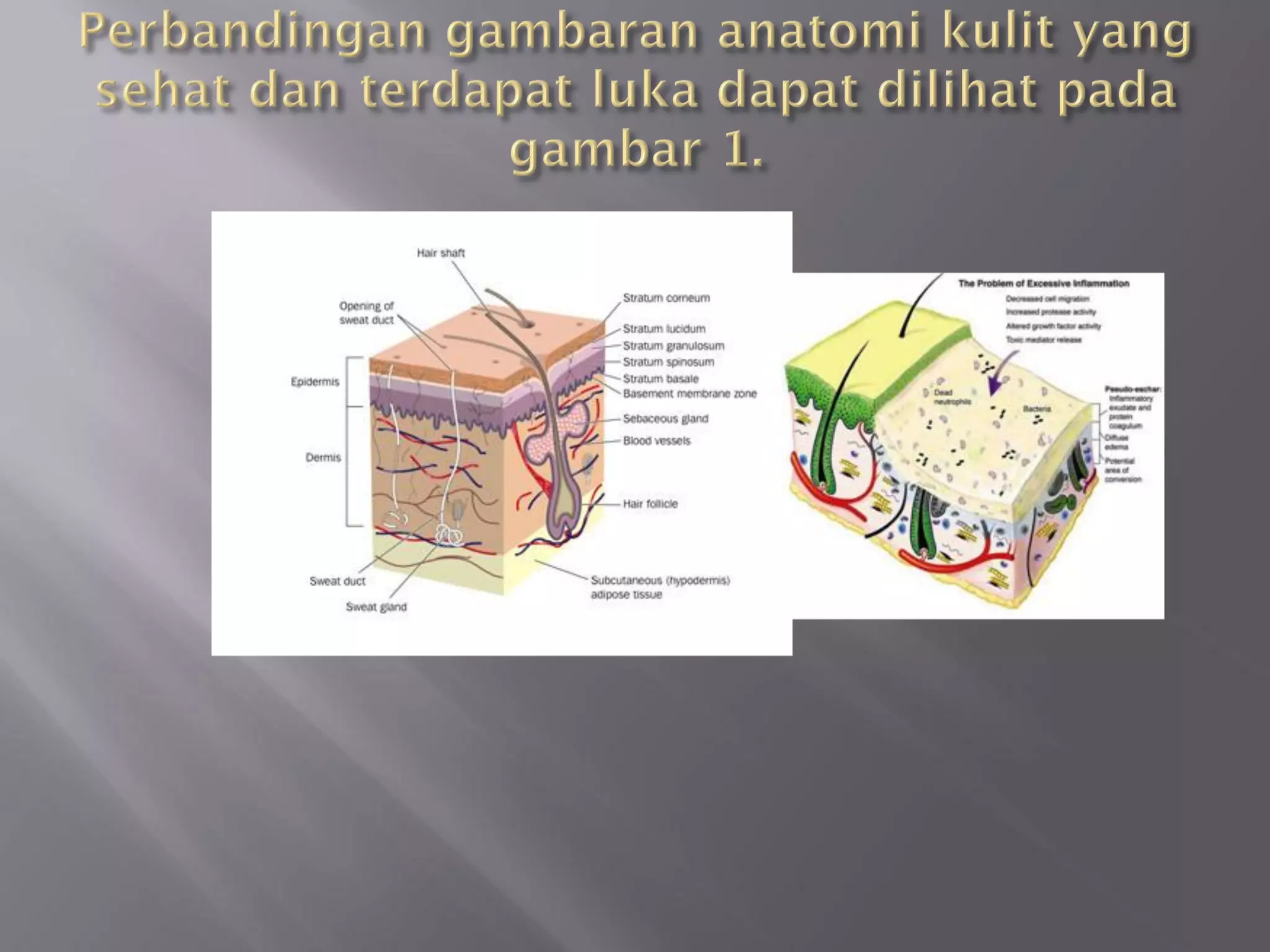 Pp perawatan luka | PDF
