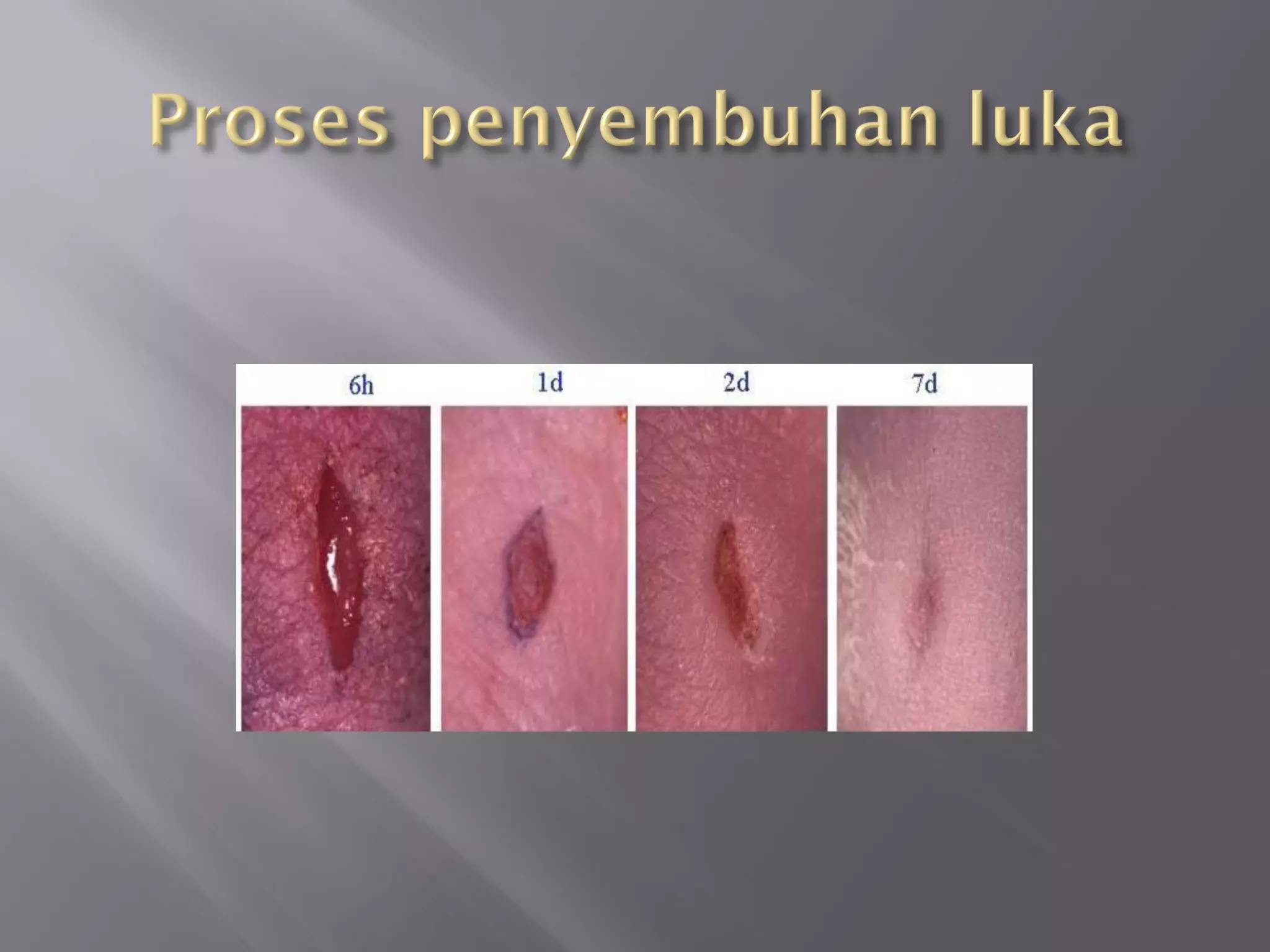 Pp perawatan luka | PDF