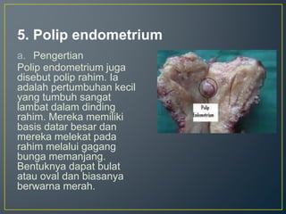 Perdarahan post partnjkkkljlkjyhuojijiii | PPT
