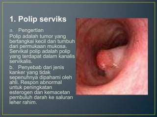 Perdarahan post partnjkkkljlkjyhuojijiii | PPT