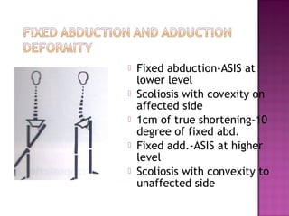 Clinical Examination of the Hip | PPT