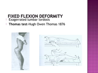 Clinical Examination of the Hip | PPT