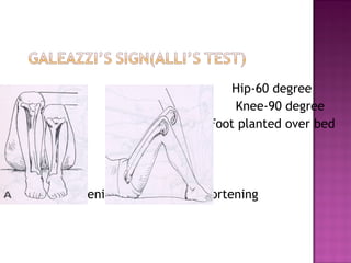 Clinical Examination of the Hip | PPT