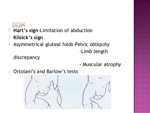 Clinical Examination of the Hip