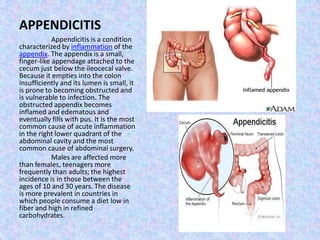 Case Presentation on Ruptured App | PPTX
