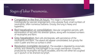 Pneumoniae in Pediatrics | PPTX
