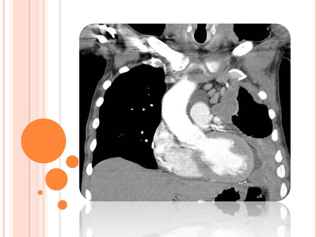 Pppppppppppppppppppppppp | PPT