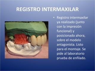 Ppr impresión modelo McCracken | PPT