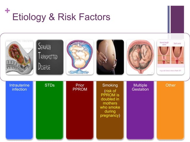 Preterm Premature Rupture Of Membranes (PPROM) | PPTX