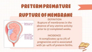 Preterm Prelabour Rupture of Membranes PDF | PDF