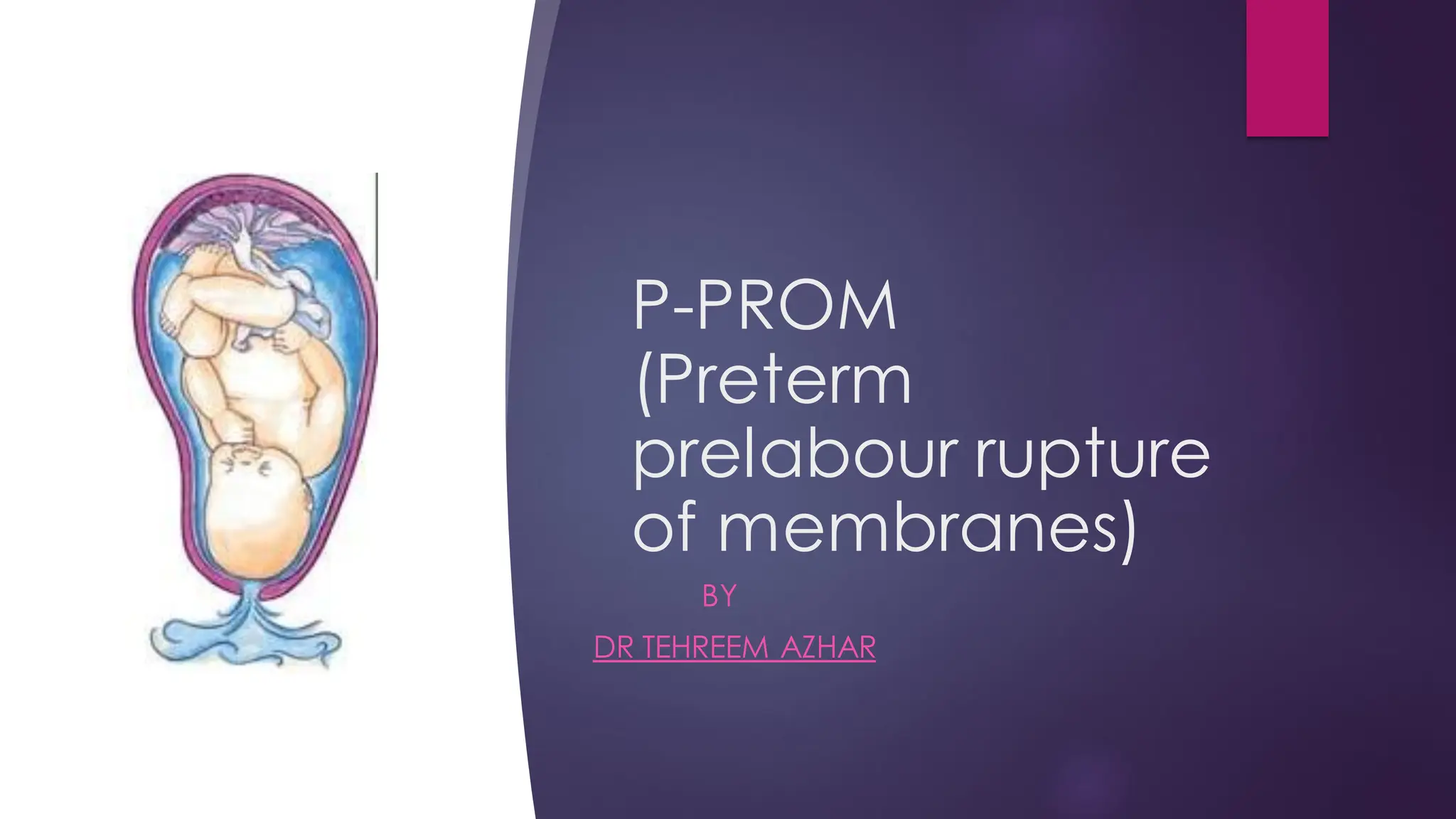PPROM(preterm prelabor rupture of membranes) | PDF