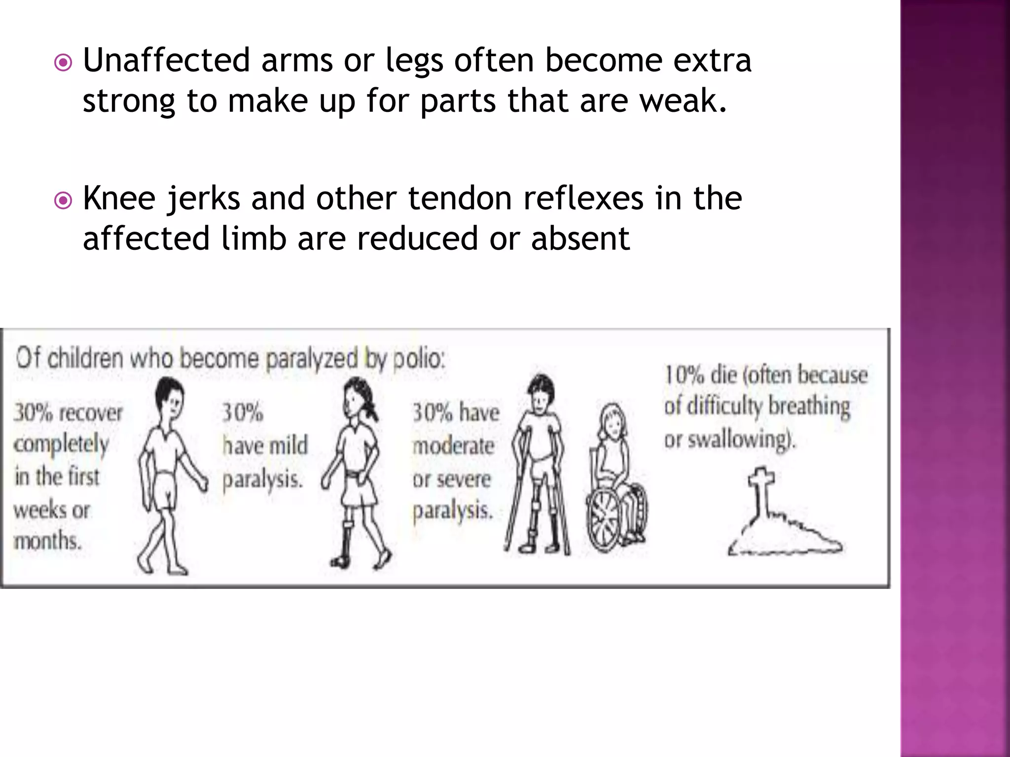 post polio residual paralysis | PPTX