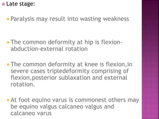 post polio residual paralysis | PPTX