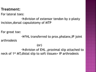 post polio residual paralysis | PPTX