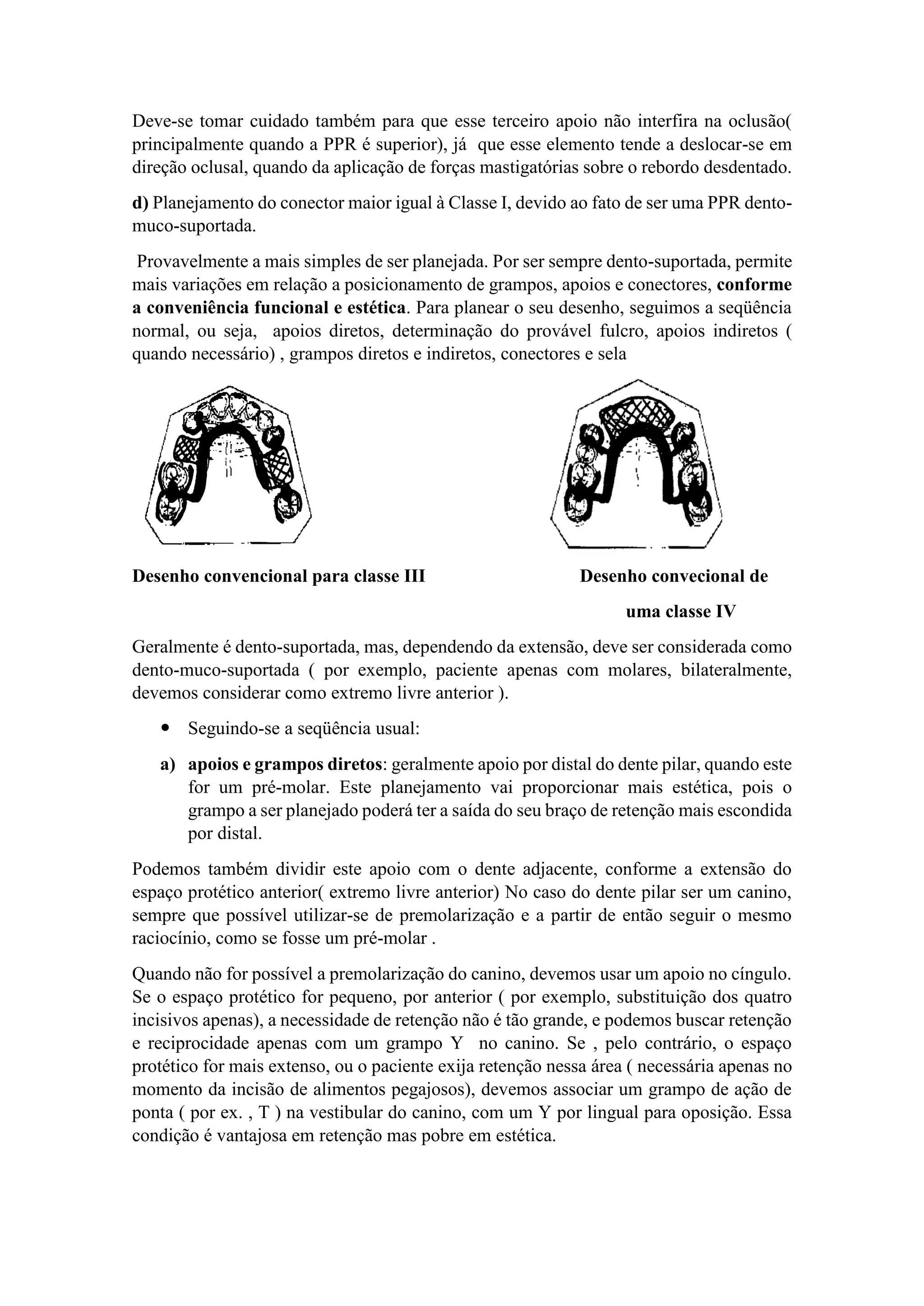 PPR(prótese parcial removivel) RESUMO.pdf