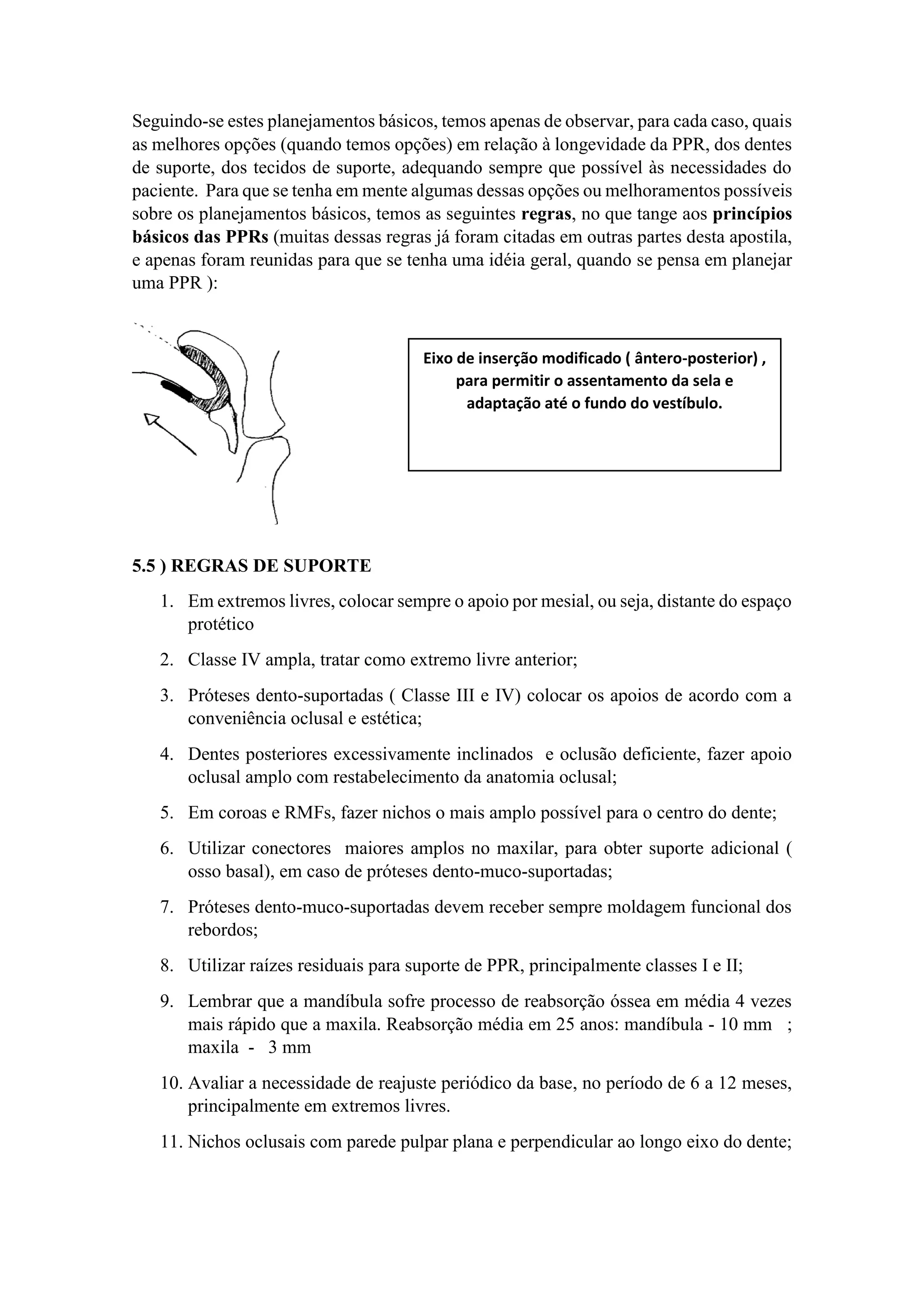 PPR(prótese parcial removivel) RESUMO.pdf