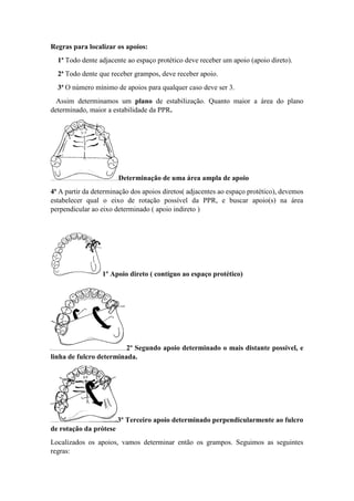 PPR(prótese parcial removivel) RESUMO.pdf