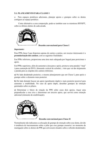PPR(prótese parcial removivel) RESUMO.pdf