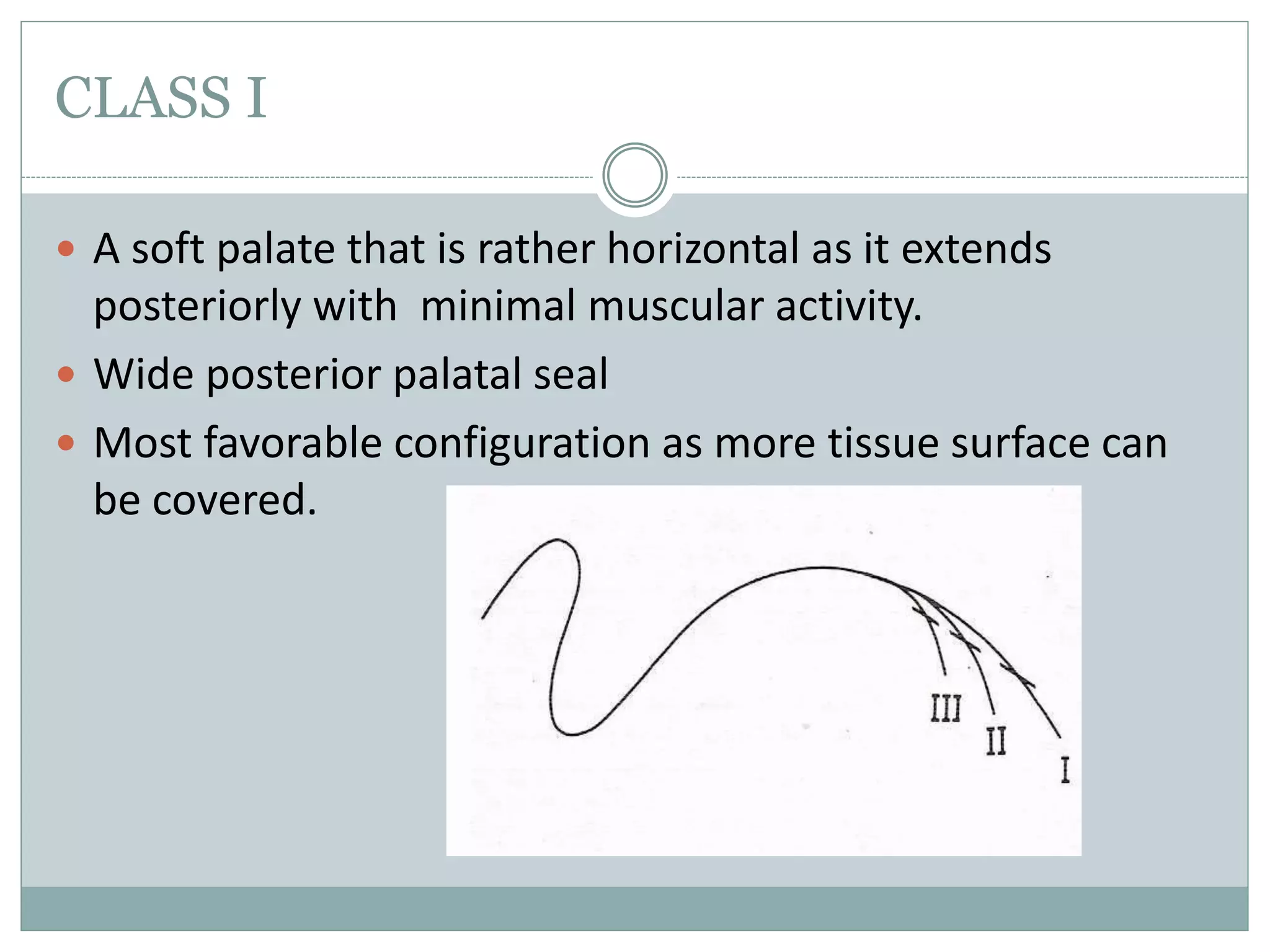 POSTERIOR PALATAL SEAL AREA | PPTX