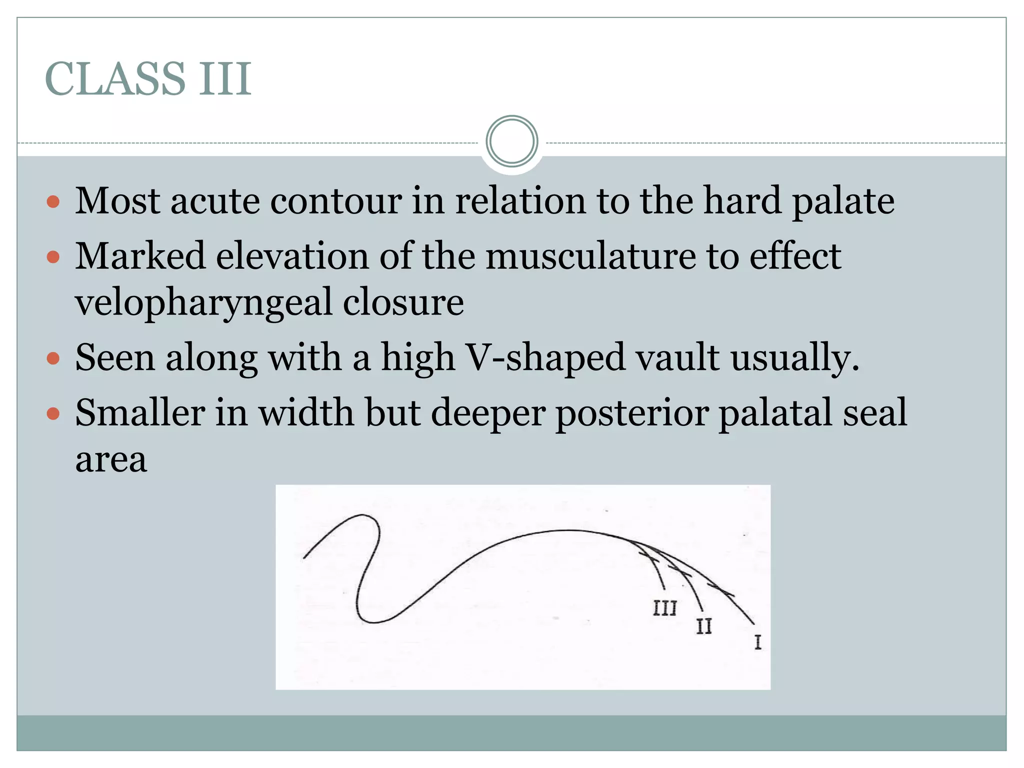 POSTERIOR PALATAL SEAL AREA | PPTX