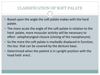 POSTERIOR PALATAL SEAL AREA | PPTX