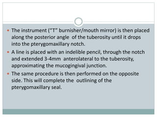POSTERIOR PALATAL SEAL AREA | PPTX
