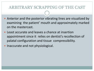 POSTERIOR PALATAL SEAL AREA | PPTX