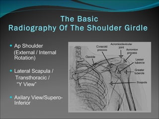 Ppshoulder | PPT